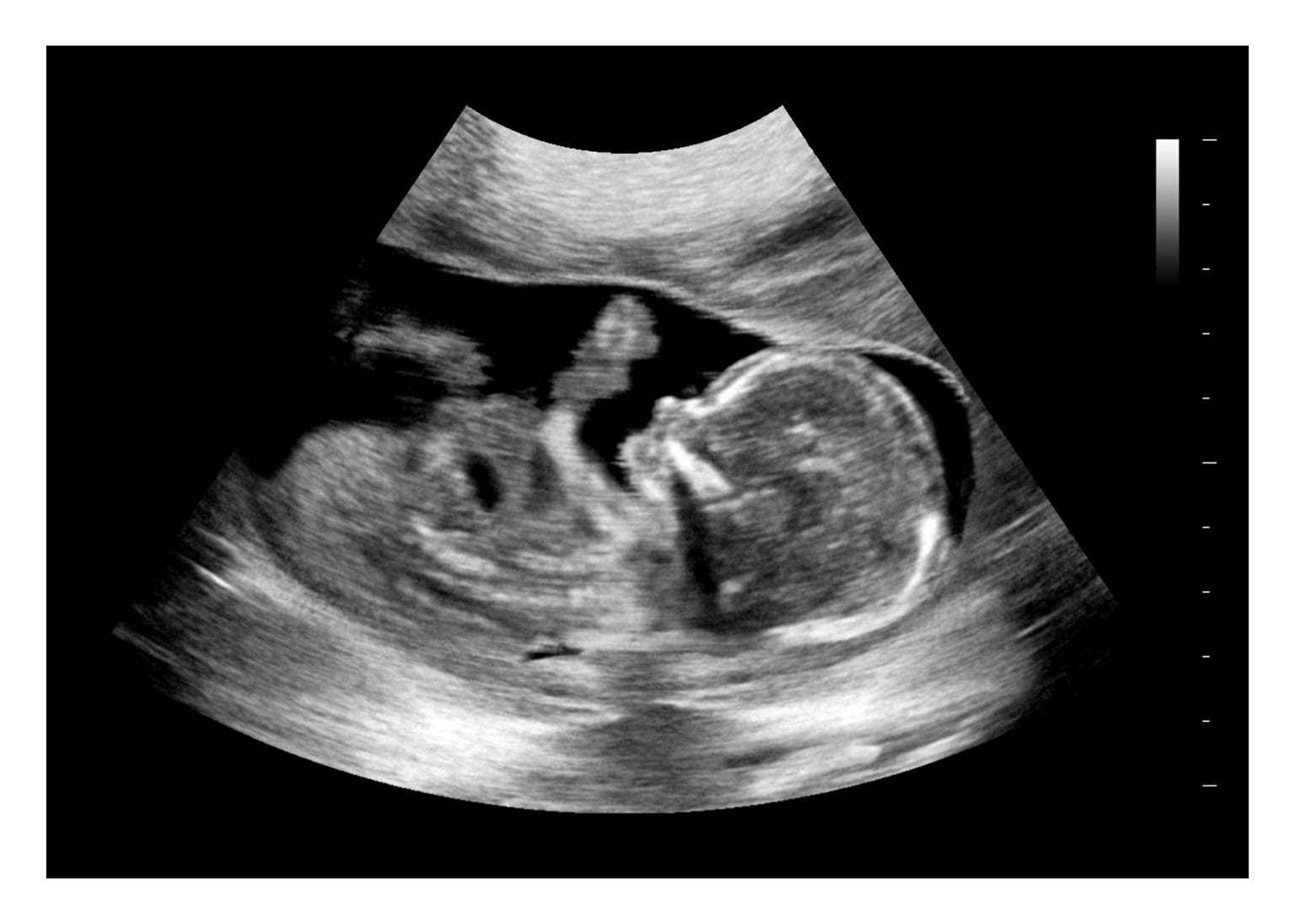 16-Weeks Fake Ultrasound | Realistic 2D Sonogram | Baby Maybe